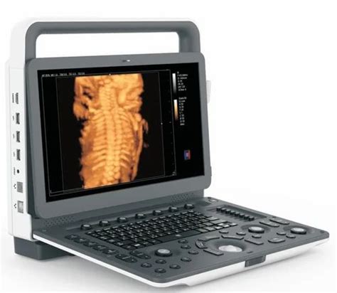 Portable Color Doppler Ultrasound Machine At ₹ 1584779 Portable