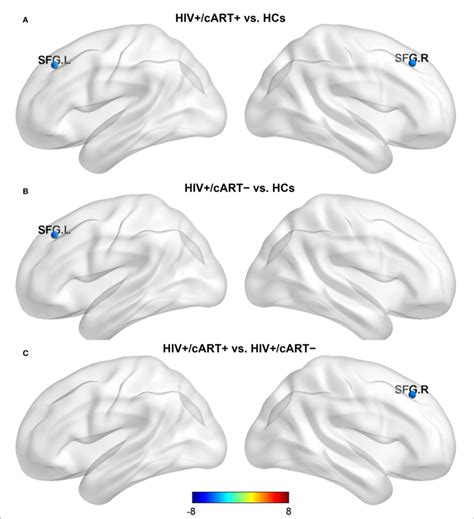 Figure Between Group Results In Regional Nodal Metrics Nlp The Color Download Scientific
