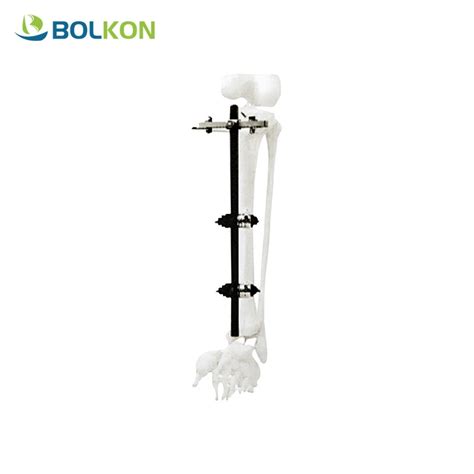Bolkon Combinational Type Bone Fracture External Fixator Elbow Joint Tibial Femoral Pelvic
