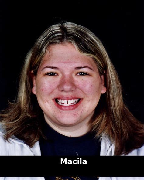 Bonding Transformation Gallery Amy Norman Dds Everett Wa