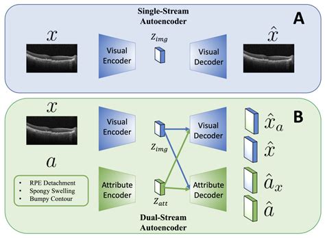 Multi Modal Learning Using Physicians Diagnostics For Optical Coherence Tomography