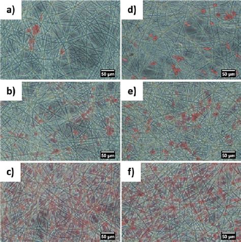 Phase Contrast Light Microscopy Images After Collagen Staining With