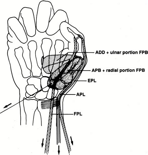Influence Of Metacarpophalangeal Joint Position On Basal Joi JBJS