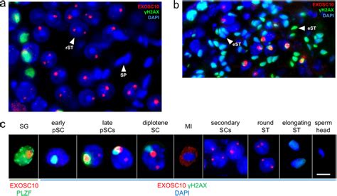 Exosc10 Localization During Post Meiotic Germ Cell Differentiation A
