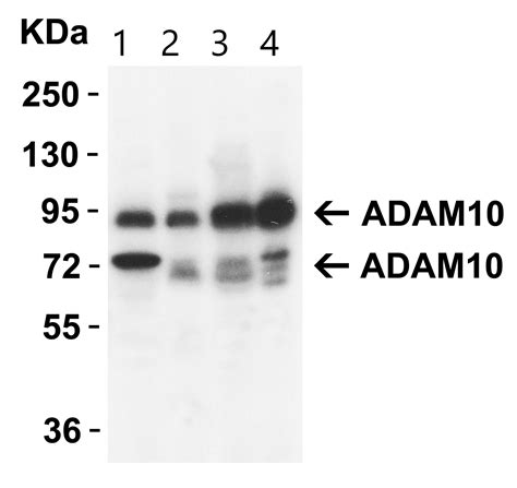 Anti Adam10 Antibody Rabbit Polyclonal Ab1997 Abcam