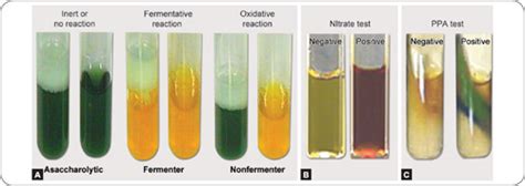 Oxidation Fermentation Test
