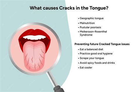 Premium Vector Causes Cracks In Tongue Medical Information