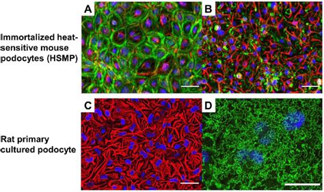 Interdigitating The Foot Process Formation With Cultured Podocytes A Download Scientific