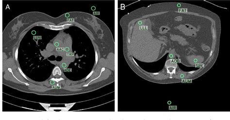 Figure 1 From Impact Of Ai Based Post Processing On Image Quality Of