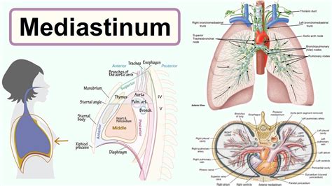 Mediastinal Mass Tumor Types Symptoms Causes Treatment 46 Off