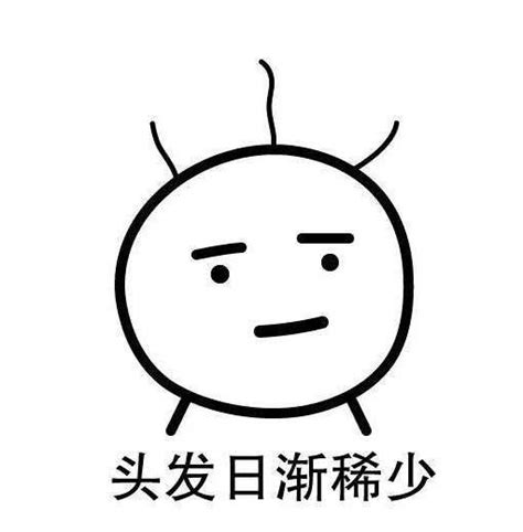 5大脫髮前兆，快看看你中招了嗎？ 每日頭條