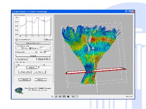 A Quantitative Dti Fiber Tract Analysis Suite 898 Ppt