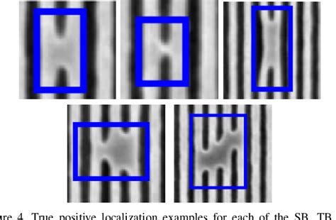 Benchmarking Feature Extractors For Reinforcement Learning Based Semiconductor Defect