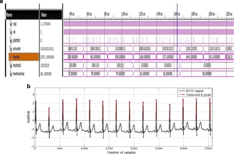 A Detection Of R Peak Location And Calculation Of Heart Rate Using Download Scientific Diagram