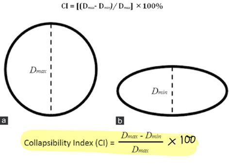 Exam 3 Ivc Pocus Flashcards Quizlet