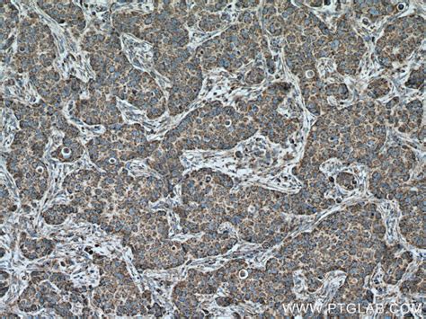Cytochrome C Antibody 66264 1 Ig Proteintech 武汉三鹰生物技术有限公司
