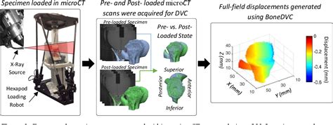 Figure 1 From Performance Of Qct Derived Scapula Finite Element Models In Predicting Local