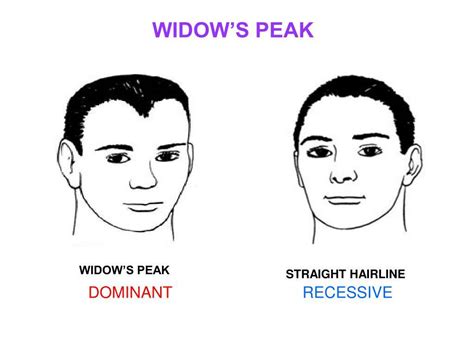Widows Peak Hairline