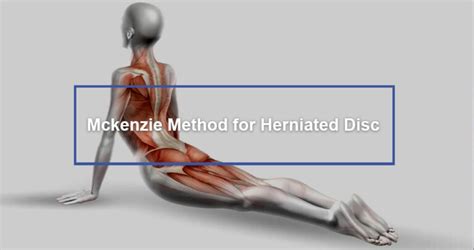 Mckenzie Method For Herniated Disc Dr Kevin Pauza The Discseel