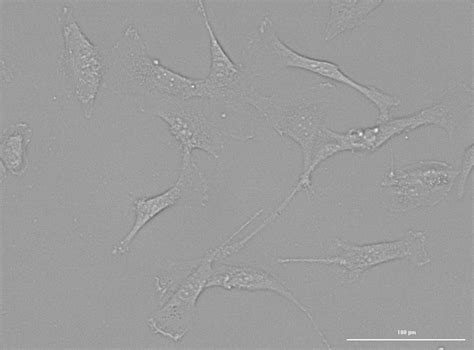 Romit Kalal Roboflow Universe