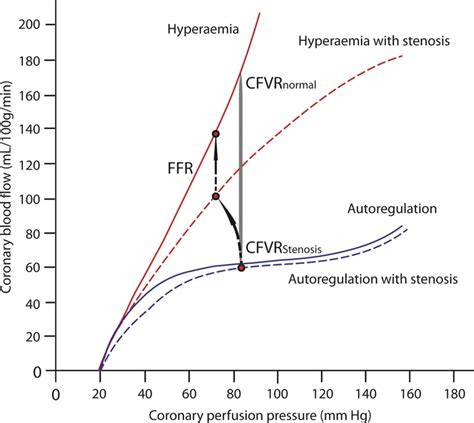 Fractional Flow Reserve And Beyond Heart