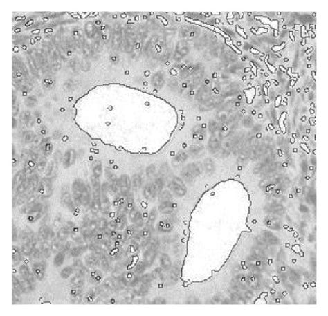 Segmentation Of Lumens Based On The Improved Spf Approach A Download Scientific Diagram
