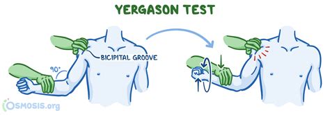 Speeds Test Shoulder