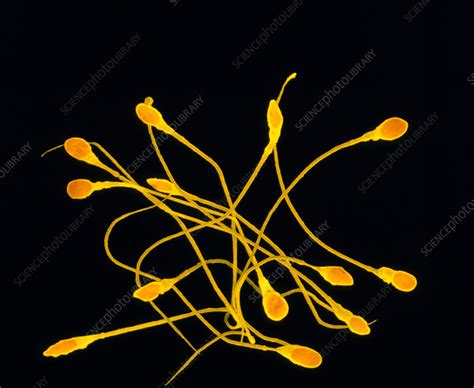 SEM Of Human Sperm Stock Image P Science Photo Library
