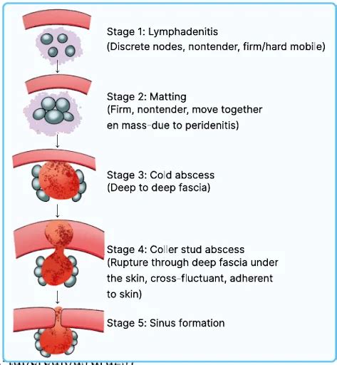 20 Must Know Surgery Flashcards Neet Pg 2025 Prepladder