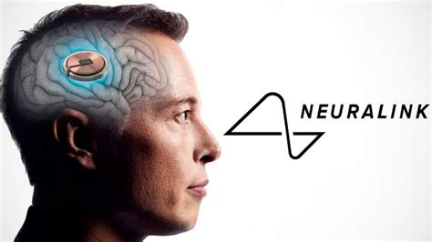 Neuralink Chip Que Podría Ser Usado En Personas Ciegas Tecnología