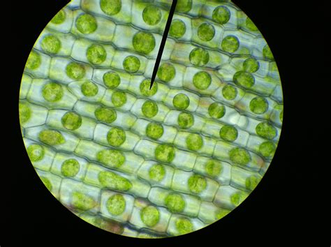 Hypertonic Plant Cell