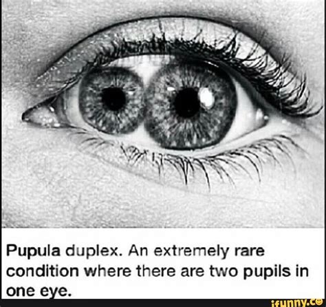 Pupula Duplex