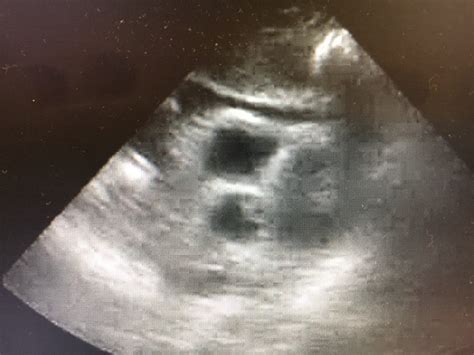 Loma Linda Ultrasound