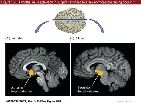 Ppt Figure 151 Organization Of The Human Olfactory System Powerpoint