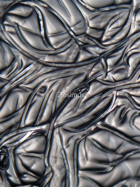 Fibers Of Cellulose Acetate Under The Microscope Iphone Case For