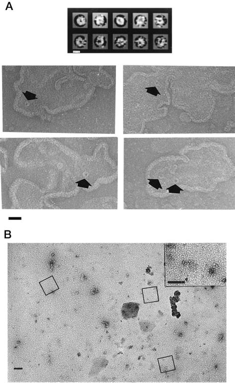 Electron Micrographs Of Negatively Stained Preparations Of Purified