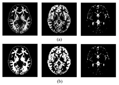 Results Of Brain Mr Image Segmentation Divided To Gm Wm And Csf Download Scientific Diagram