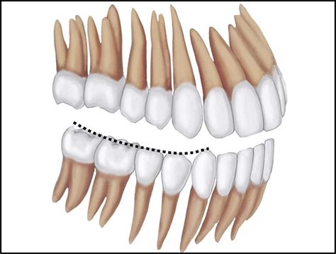 Curve Of Spee Sdcindia