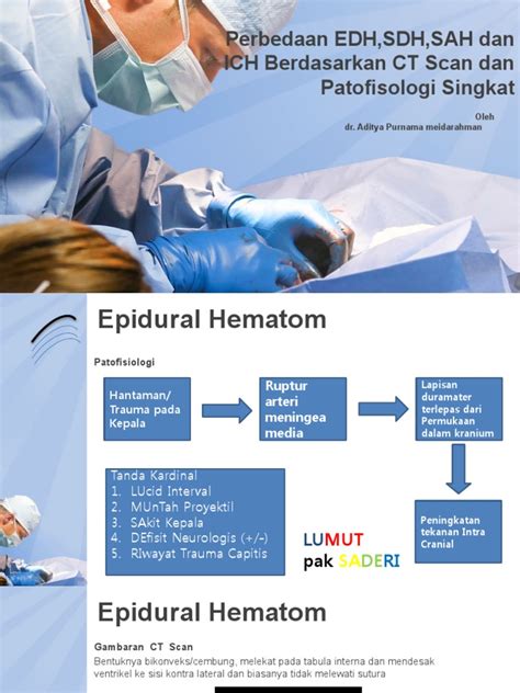 Perbedaan Edh Sdh Sah Ich Berdasar Ct Scan Pdf