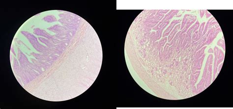 Digestive Histology 6 Diagram Quizlet