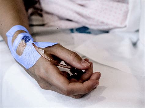 What Are The Stages Of Catheter Related Phlebitis