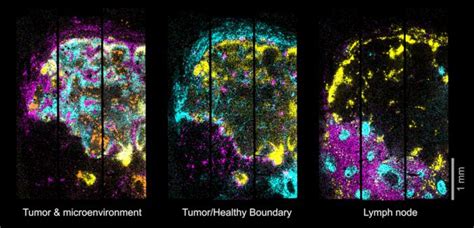 Spatial Transcriptomics Platform Promises Low Cost High Res 3d Mapping American Biotech News
