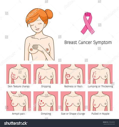 乳がんの症状を示す裸の女性のアイコンのベクター画像素材ロイヤリティフリー 678260830 Shutterstock