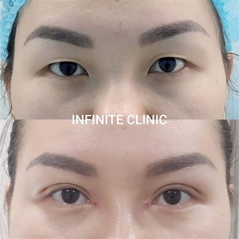 Утсан Infinite Clinic Арьс гоо сайхны мэс заслын эмнэлэг