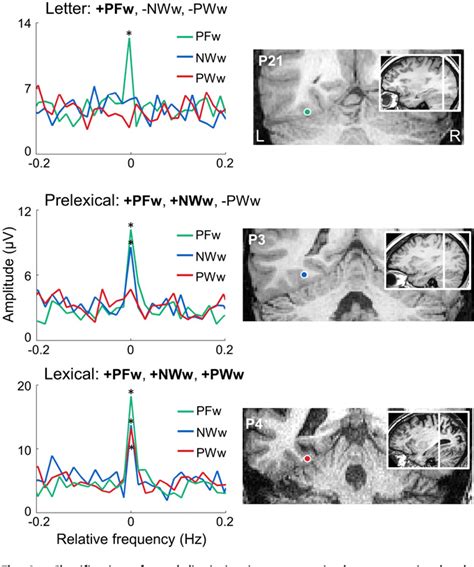 Figure 1 From Selective Visual Representation Of Letters And Words In The Left Ventral Occipito