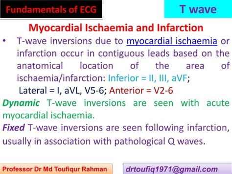 Approach To A Patient With T Wave Abnormality In ECG PPSX Heart And Cardiovascular Diseases