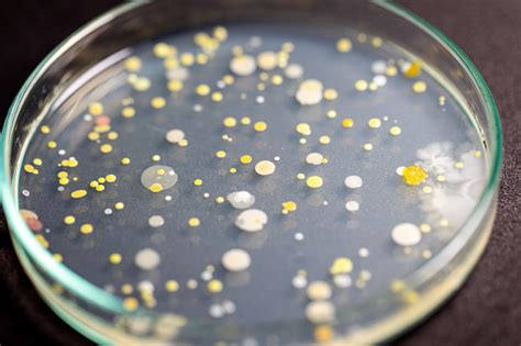 미생물학 실험실에서 교육을 위한 토양 샘플에서 천접시에서 자라는 특성과 다양한 모양의 박테리아 및 곰팡이 의 배경 0명에 대한 스톡 사진 및 기타 이미지 Istock