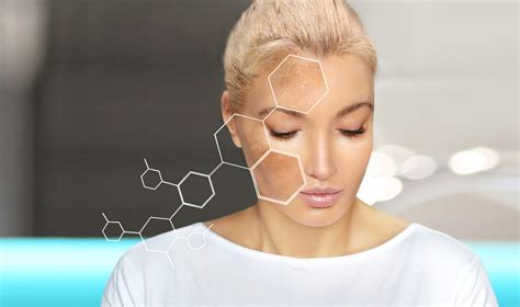 Treatment Of Pigmentation Advanced Skin Academy