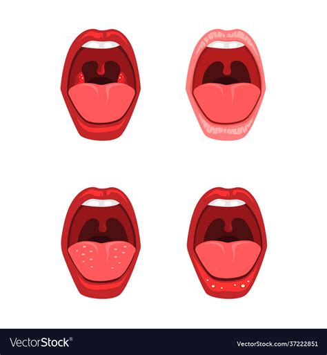 Healthy Throat Images