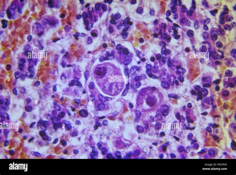 Cytomegalovirus Cmv Revealed In The Scanning Electron Microscope Sem